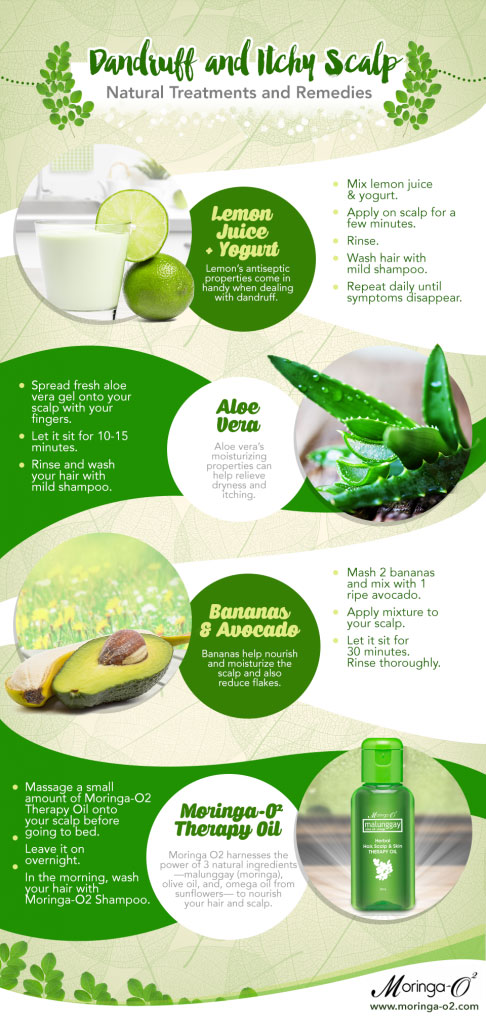 Natural Treatments for Dandruff and Itchy Scalp Natural Treatments for Dandruff and Itchy Scalp